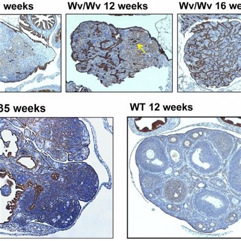 Working Model For Follicle Depletion And Ovarian Aging In Ovarian Download Scientific Diagram