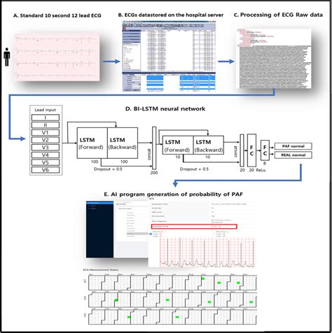 Description Of The Artificial Intelligence Algorithm For Detecting Paf