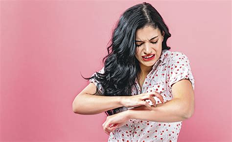 అలర్జీని ఎలా వదిలించుకోవాలి How To Identify Scalp Allergy And Tips To Prevent It In Telugu