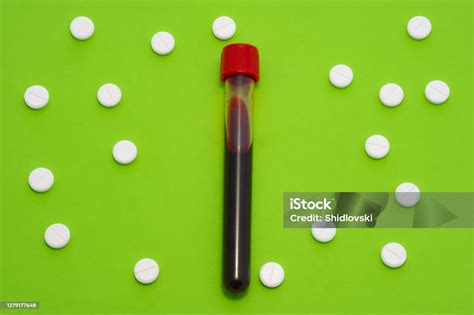 혈액을 가진 실험실 시험 관은 물방울 무늬의 장식을 구성하는 흰색 정제로 둘러싸인 녹색 배경에 있습니다 의학 혈액학 혈액 질환 진단에 사용하기위한 개념 예술 사진 0명에