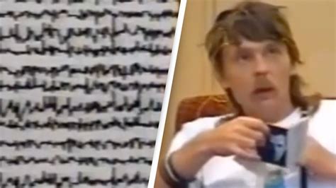 Video Shows Brainwaves Of Patient Having Epileptic Seizure