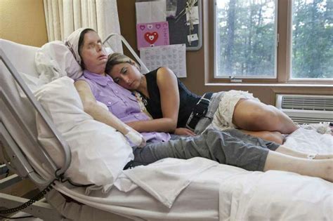 Victim Of Chimp Attack Cant Sue State