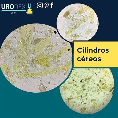 Los Cilindros Céreos Derivan Su Nombre De Su Apariencia Ya Que