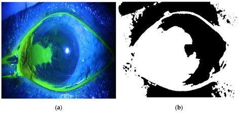 Diagnostics Free Full Text Automated Detection Of Corneal Ulcer Using Combination Image