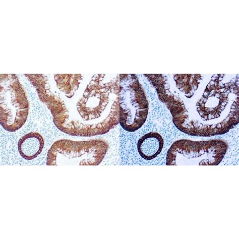 30 Minute Ihc Dab Detection System A320597