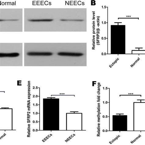 Identification Of Aberrantly Methylated Differentially Expressed Genes Download Scientific