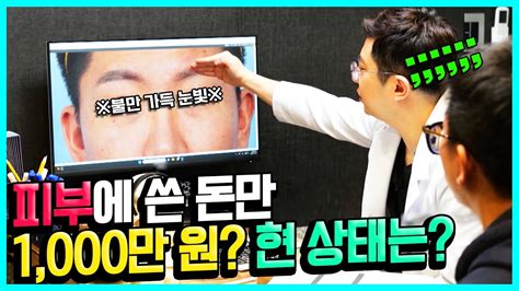 20대부터 피부에 쓴 돈만 1000만 원 ㄴㅇㄱ 그런데 더 충격적인 것은ㅣmake미남 Youtube