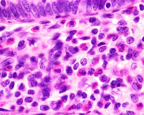 Human Appendix Eosinophils Stock Photo Image Of Microscopy White 270581076