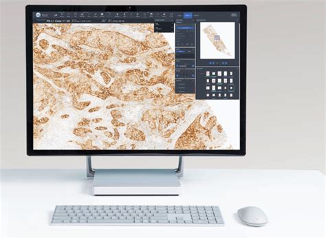 한국로슈진단 ‘upath Pd L1 Sp263 이미지 분석 알고리즘