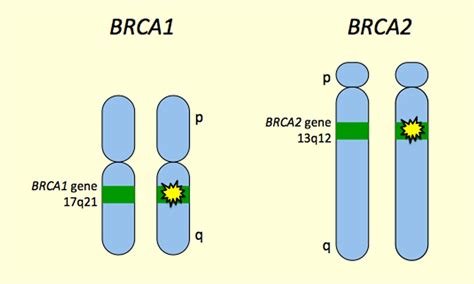 Potential Interactions Between Brca1 Or Brca2 Gene Defects And Des