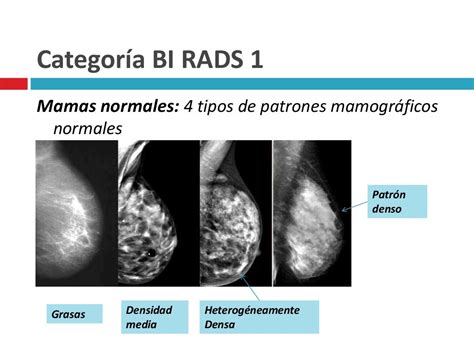 Acr Bi Rads Categoria 1 Retoedu