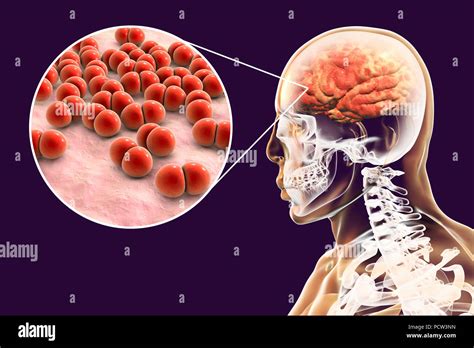 Streptococcus Pneumoniae Diagram