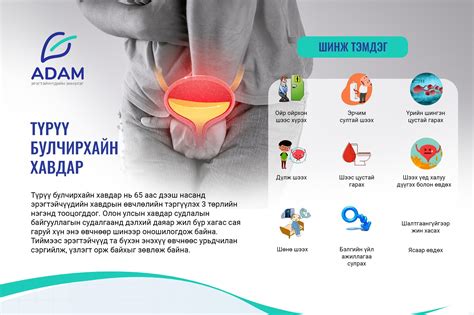 АДАМ эрэгтэйчүүд АДАМ эрэгтэйчүүд бөөрний эмнэлэг