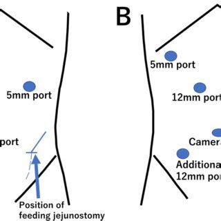 Port Placement A The Operator Used The Two Ports On The Right Side Download Scientific
