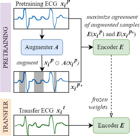 Figure 1 From Pretraining Ecg Data With Adversarial Masking Improves