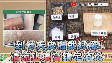 一到冬天皮膚就好癢！ 清涼止癢膏 鎮定消炎 冬季乾癢不煩惱！健康20 精華 蔡逸姍 吳明珠 Youtube