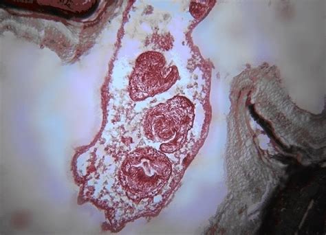 Metacestode Structures Containing Protoscoleces In Arvicola Terrestris