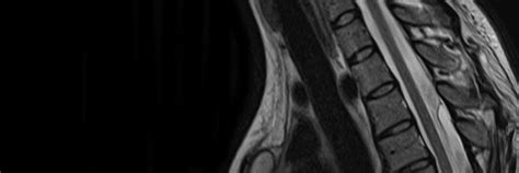 Mri Gallery Paediatric Mri Series Mri Spine Mri At Melbourne Radiology Clinic