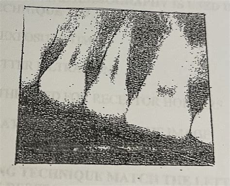 Radiology Part 8 Exposure Technique Test Flashcards Quizlet