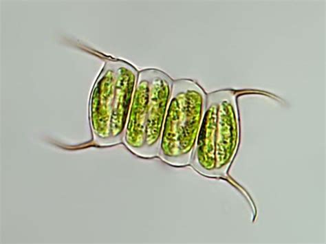 Do It Yourself Conservation How To Count Plankton Artofit