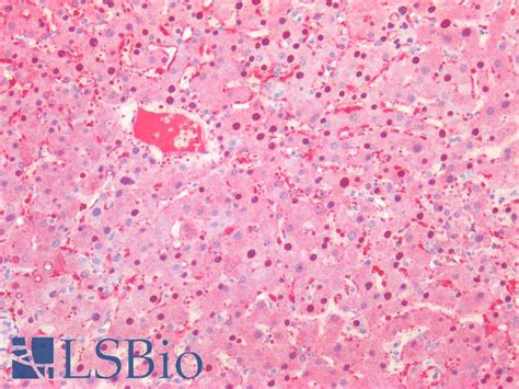 Ihc Plus™ Pgm1 Phosphoglucomutase 1 Monoclonal Antibody Mouse Lsbio