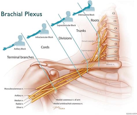 Brachial Plexus Nerve Block Procedure