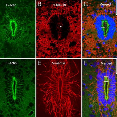 Fluorescence Microscopic Localization Of F Actin A Tubulin And