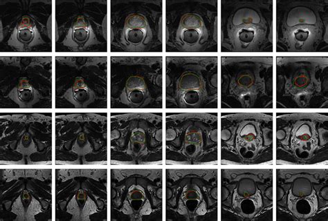 Experimental Data And Segmentation Results Download Scientific Diagram