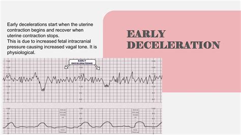 Cardiotocography A Fetal Hr Monitoring Method Pptx