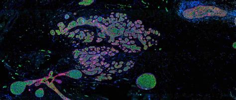 The Emergence Of Spatial Omics Unveiling The Hidden Dimensions Of Biology