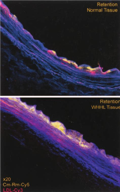Visual Comparison Of The Retention Of LDL Red And Chylomicron Download Scientific Diagram