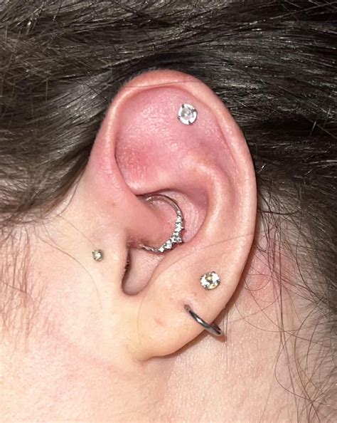 Nipple Piercing Irritation Bump Rpiercingadvice