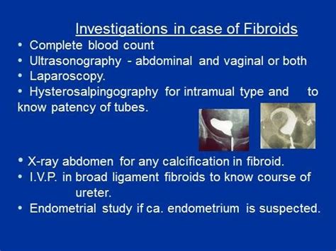 Fibroids A Presentation