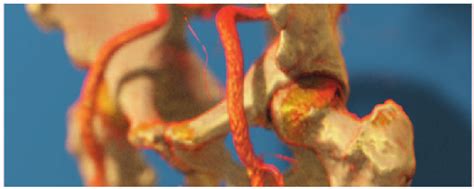 Depth Of Field Rendering In Exposure Render Download Scientific Diagram