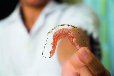 Removable Retainer Dental Retainers Gibbs Orthodontic Associates