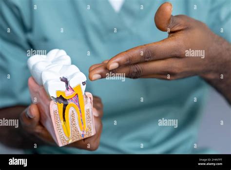 Model In The Clinic Displaying The Structure Of Teeth Including Enamel Dentine And Cementum