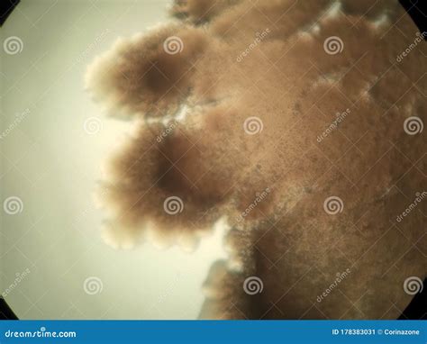 Branched Bacterial Colonies Under The Microscope Stock Image Image Of Isolated Patterns