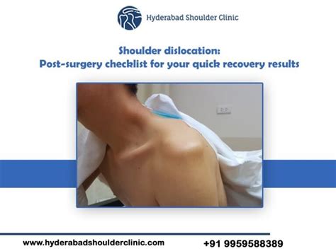 Shoulder Dislocation Post Surgery Checklist For Your Quick Recovery Results Shoulder Clinic