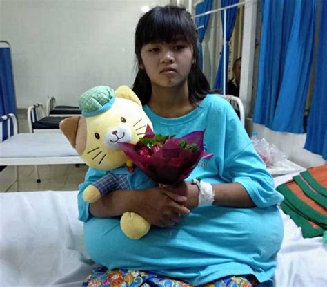 ရင္သားအဆမတန္ႀကီးထြားသည့္ ရွမ္းမိန္းကေလးငယ္ ခြဲစိတ္ကုသမႈစတင္ခံယူ