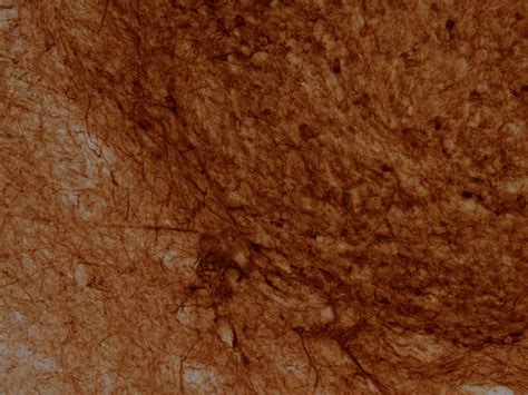 Th Cell Quantification Object Detection Dataset By Bnl