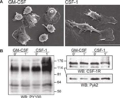 Csf 1 Regulates Macrophage Morphology Through Upregulation Of Download Scientific Diagram