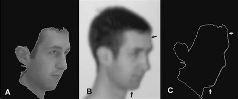 Figure 1 From Evaluation Of Morphometric Matching For The