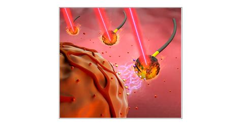 Biohybrid Flexible Sperm Like Microrobot For Targeted Chemo Photothermal Therapy ACS Applied