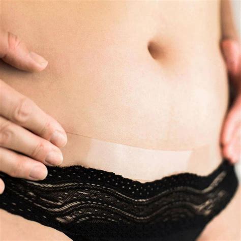 Tummy Tuck Scar Heal Kit Long 55cm