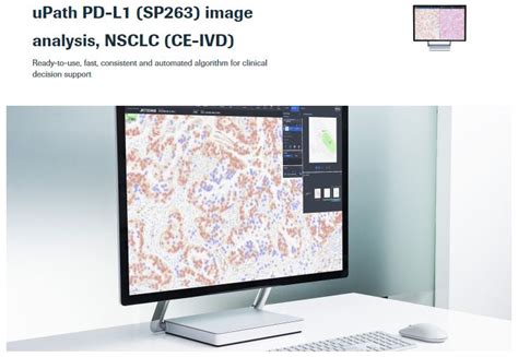 罗氏推出自动化数字病理算法upath Pd L1，提高肺癌 Nsclc 诊断的速度和准确性！ 生物标志物专区 生物谷