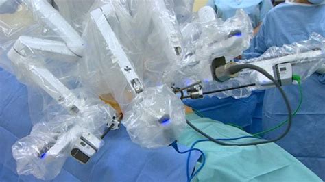 Prostate Cancer Robot Gets To Work At Cardiff Hospital Bbc News