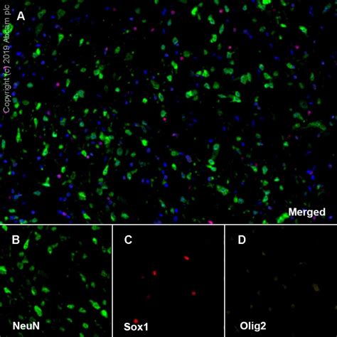 Recombinant Anti Neun Antibody [epr12763] Neuronal Marker Ab177487 Abcam