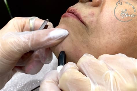 جزییات مرکز زیبایی بلومون جوان سازی پوست، لیزر موهای زائد