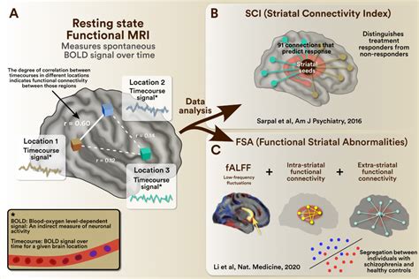 Schizophrenia Brain Activity