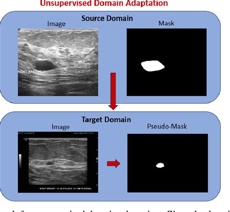Enhancing Ai Diagnostics Autonomous Lesion Masking Via Semi Supervised Deep Learning Paper And